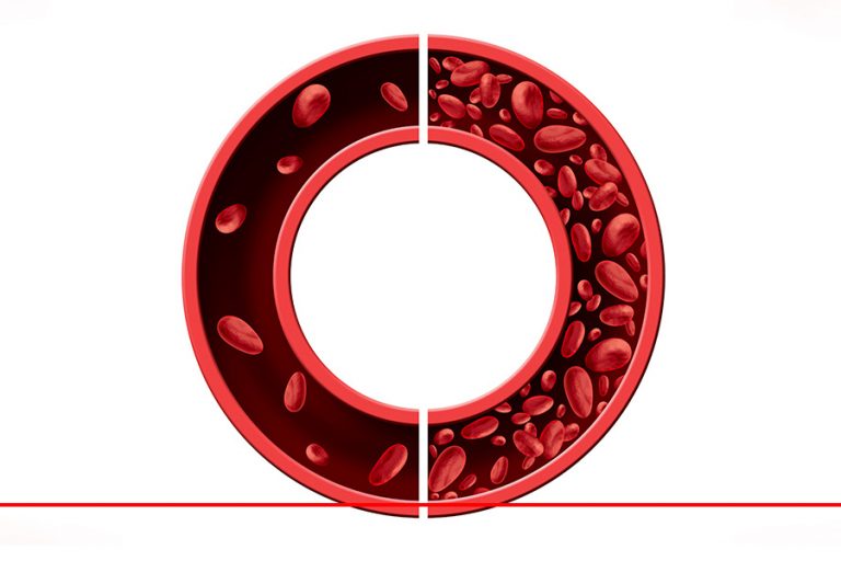 Reolin | Reolin iron revolution | Anemia treatment